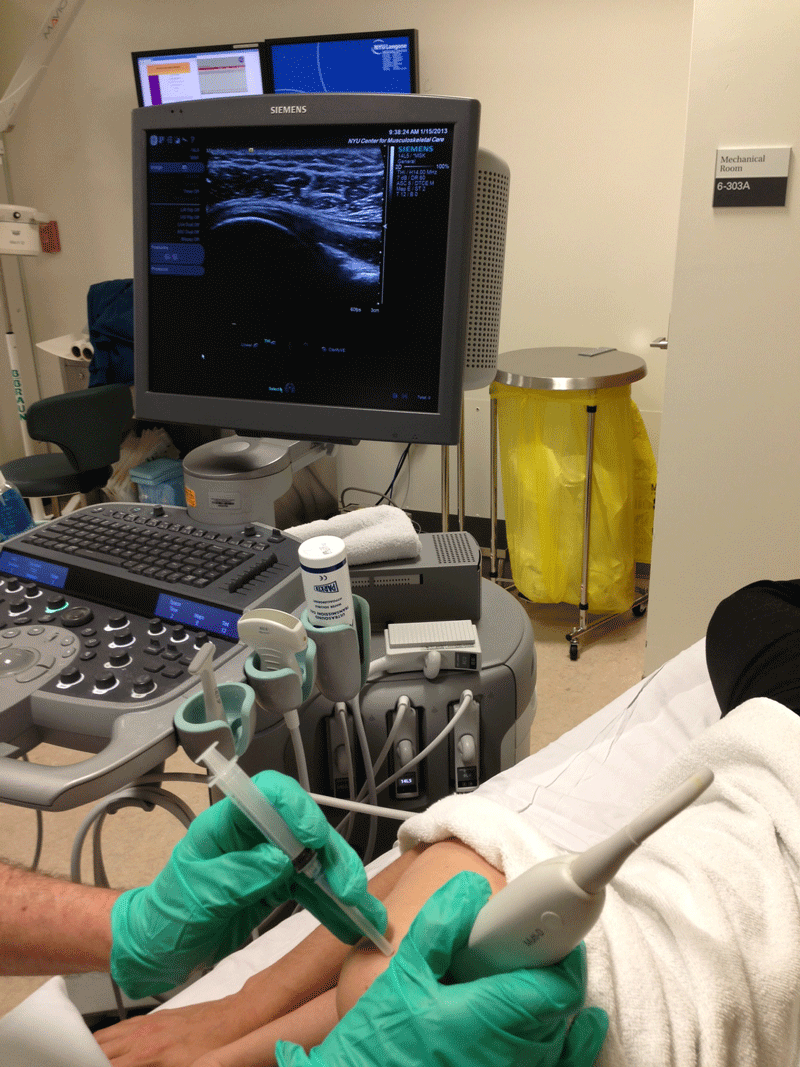Shoulder Arthrogram Injection